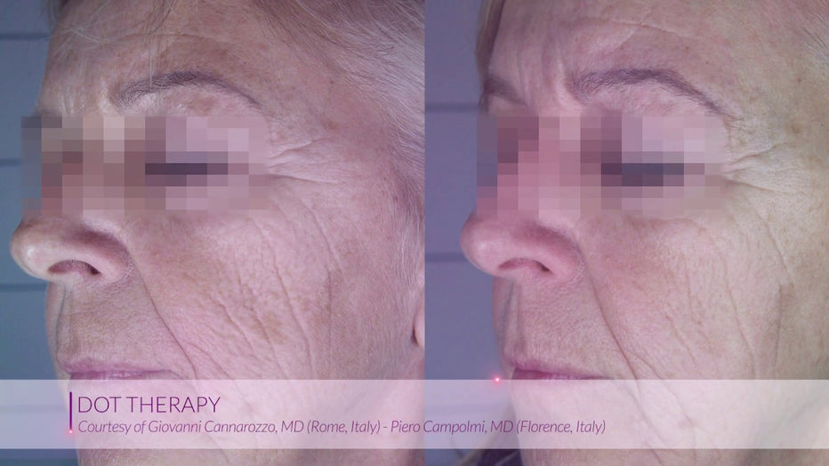 DOT Therapy Echuca – Skin Aesthetics Moama